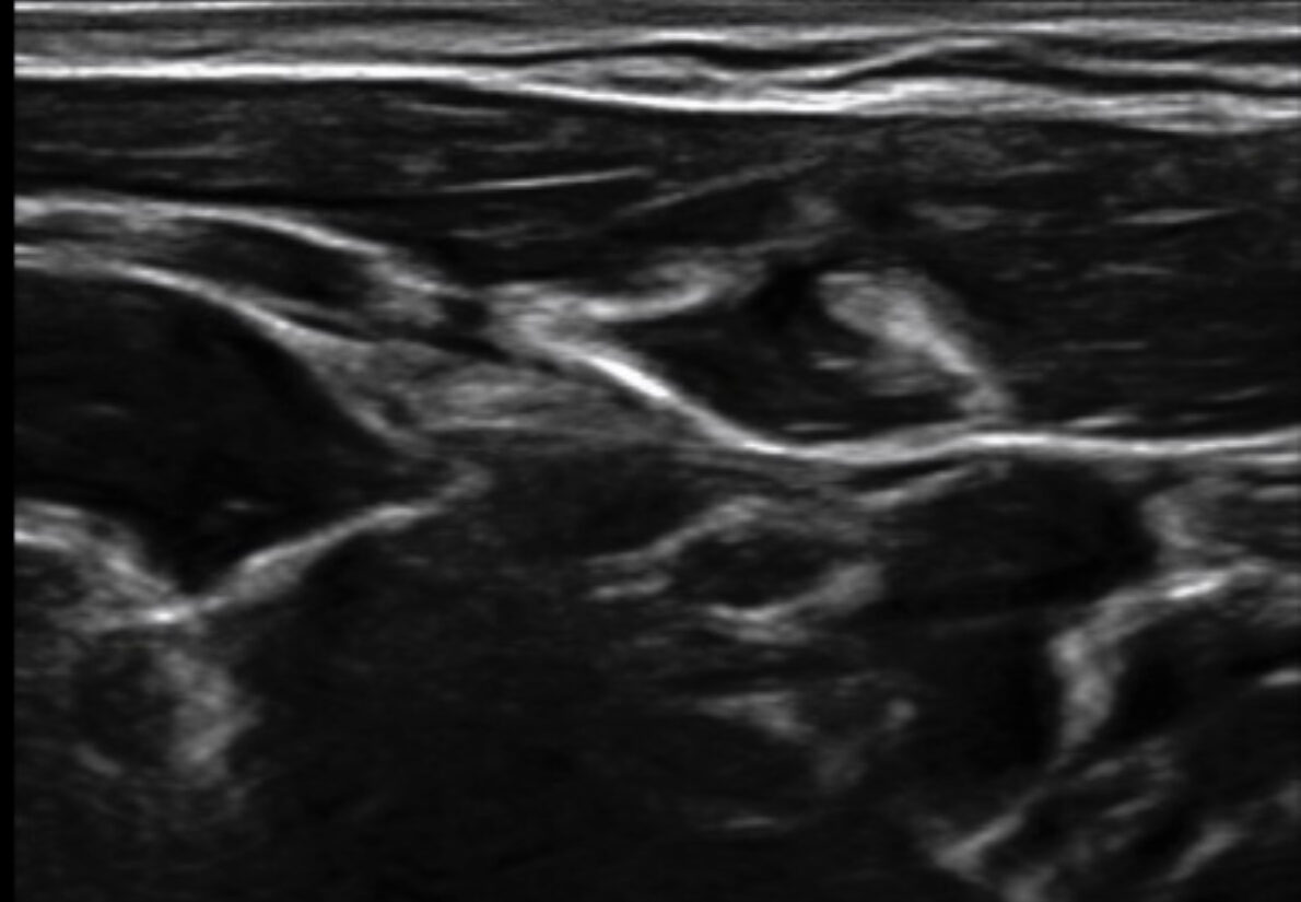 How it works | SmartAlpha